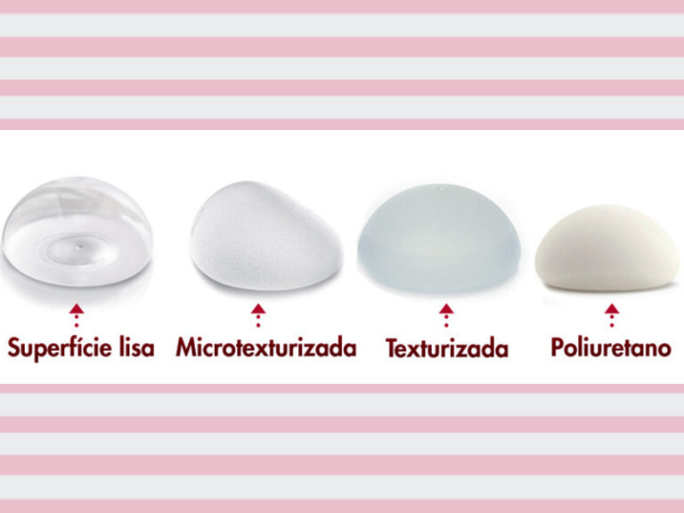Qual a Melhor Marca de Prótese de Silicone: Veja 12 Principais