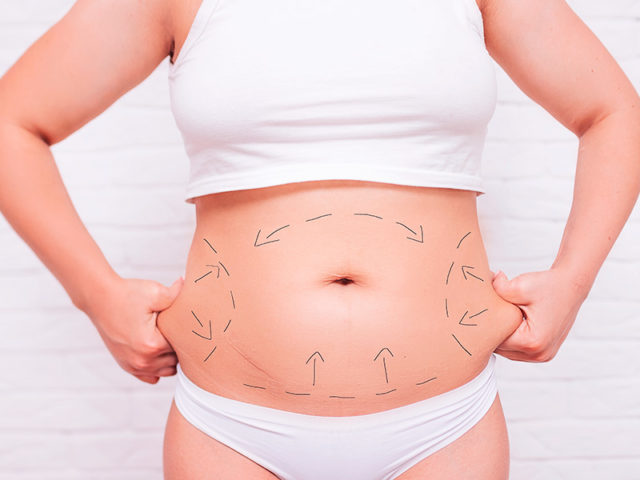 Como Perder Barriga Saiba O Que Funciona L Dream Plastic