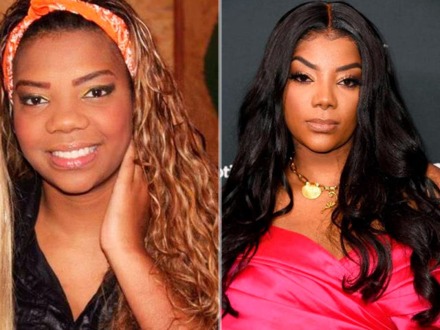 Leona Lewis Plastica No Nariz Antes E Depois