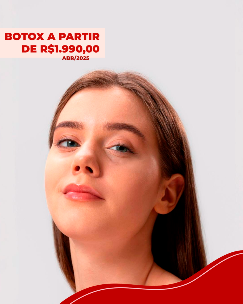 Botox no Rosto | Antes e Depois e Preço | Dream Plastic