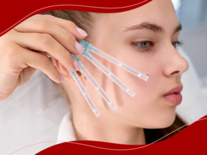 Fios de PDO - Dream Plastic - Cirurgia Plástica SP